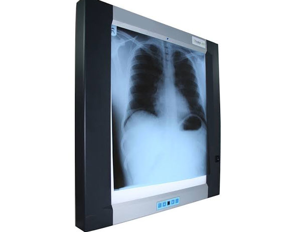 X Ray Panel-HATEEN ELECTRICAL REMOTE CONTROL L.L.C.